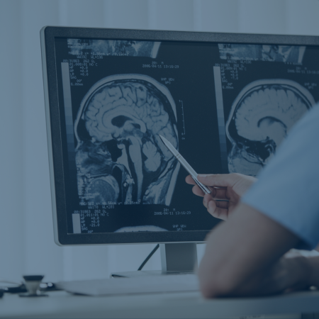 New Study Highlights Dangers of Slap Fighting - Brain Injury Association of America